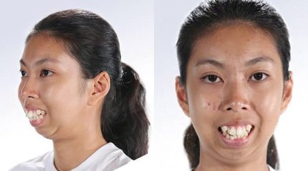 Woman Born with No Chin Completely Transformed by Plastic Surgery ...